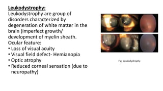 Ocular menifestation of neurological diseases | PPT