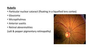 Ocular menifestation of neurological diseases | PPT