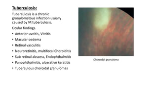 Ocular menifestation of neurological diseases | PPTX