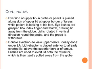 Ocular methods | PPTX