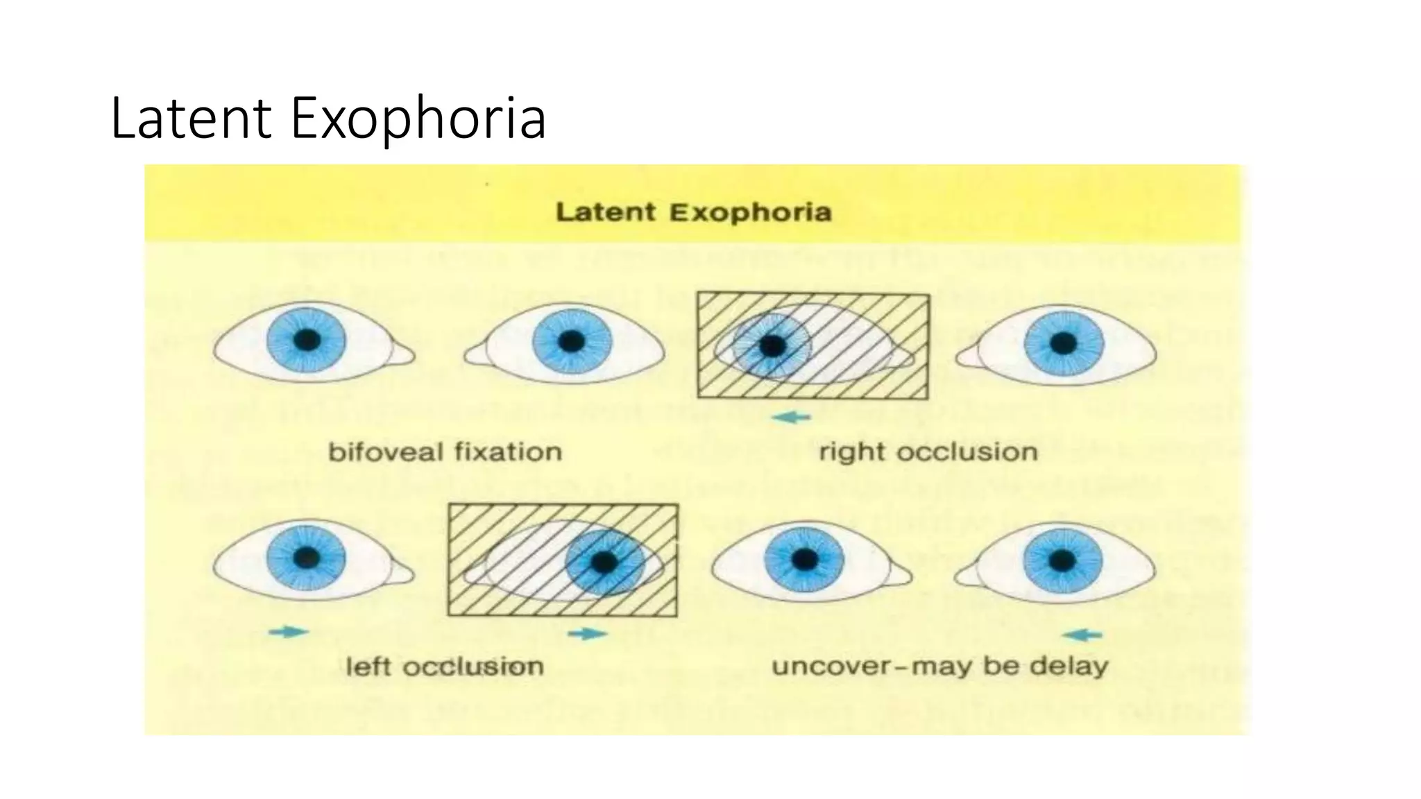 OCULAR MOTILITY.pptx