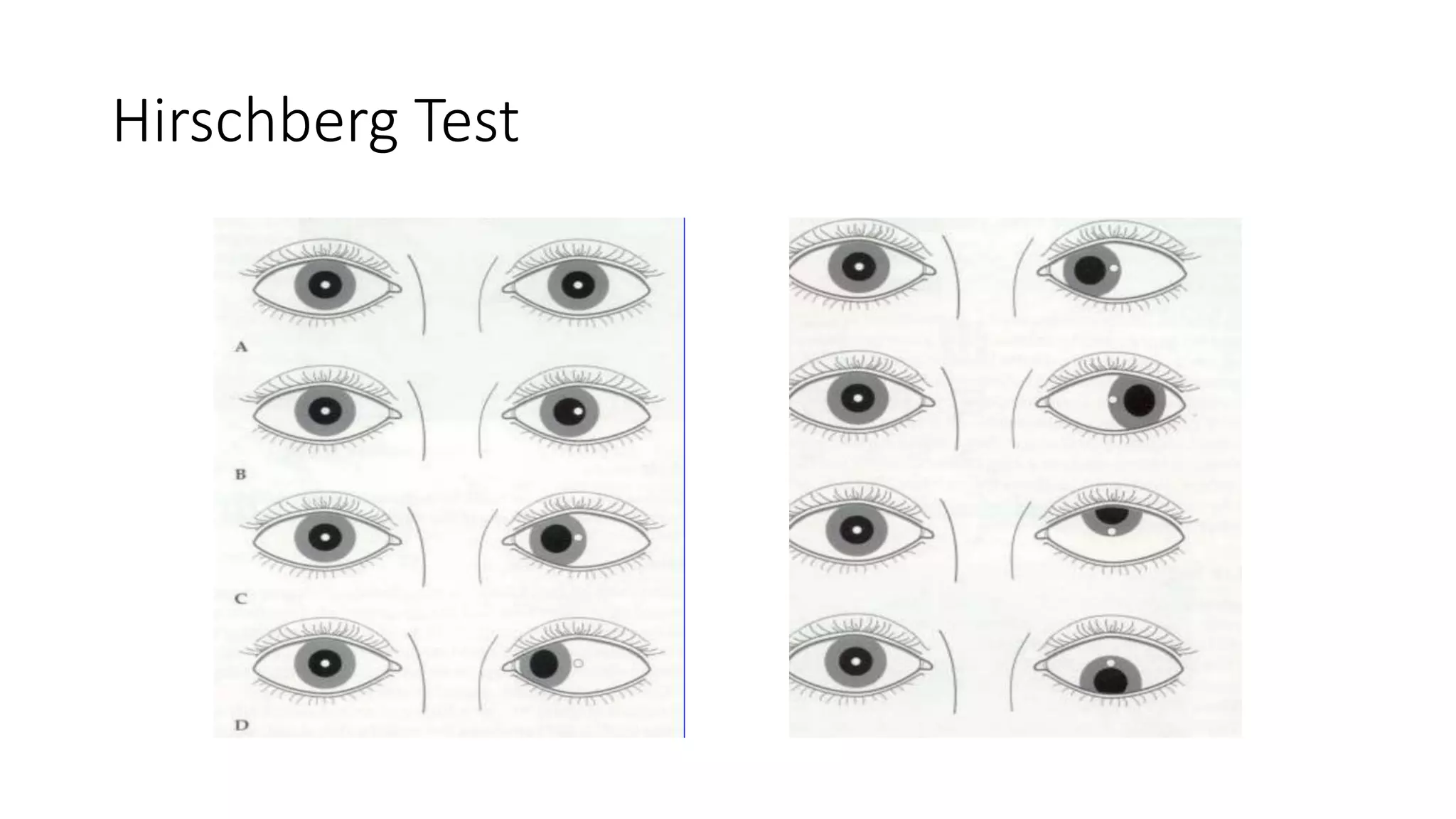 OCULAR MOTILITY.pptx