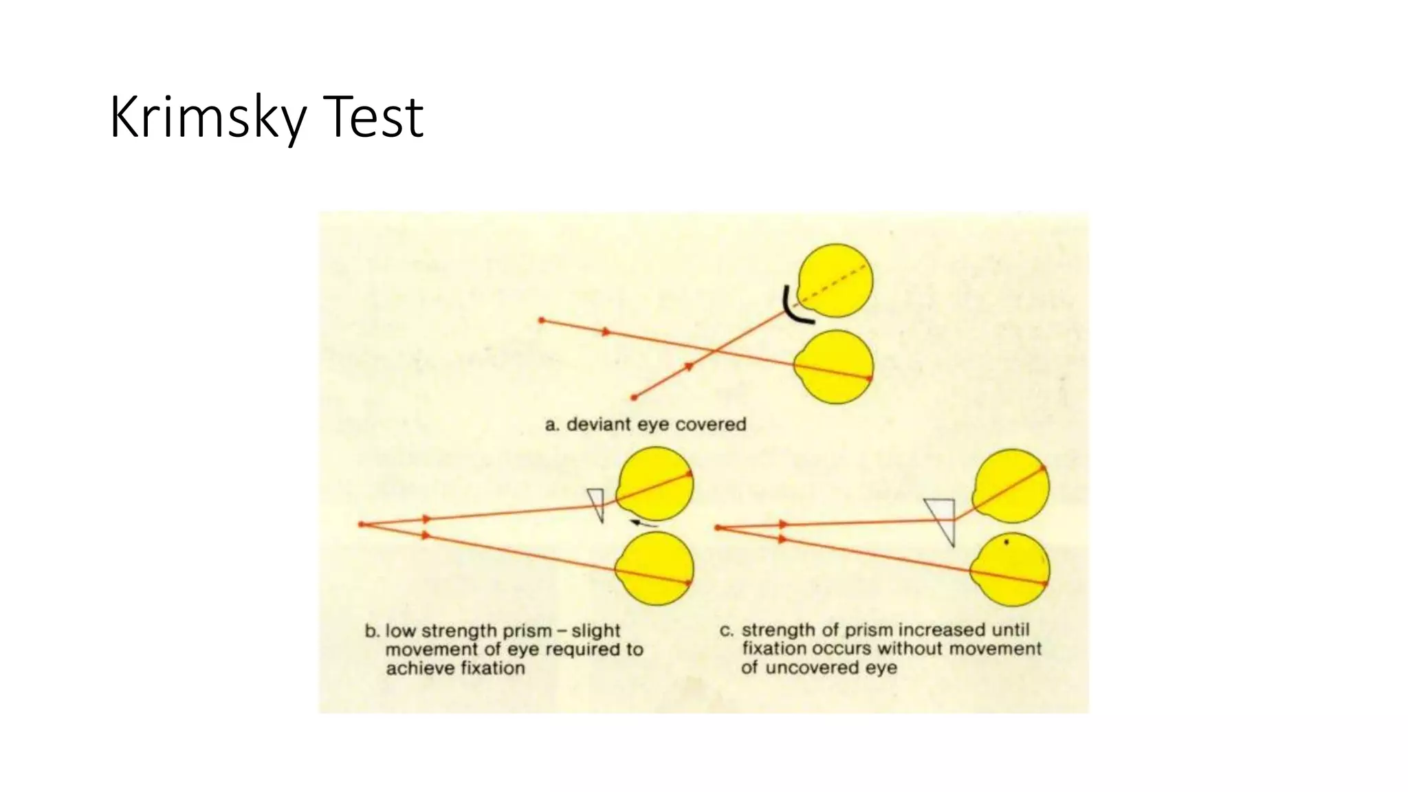 OCULAR MOTILITY.pptx
