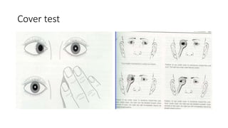 OCULAR MOTILITY.pptx