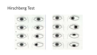 OCULAR MOTILITY.pptx