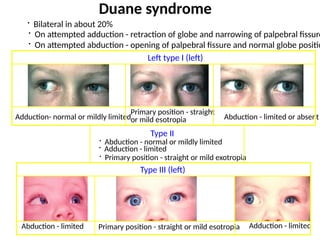 OCULAR MOTILITY.pptx ocular motility slit | PPTX