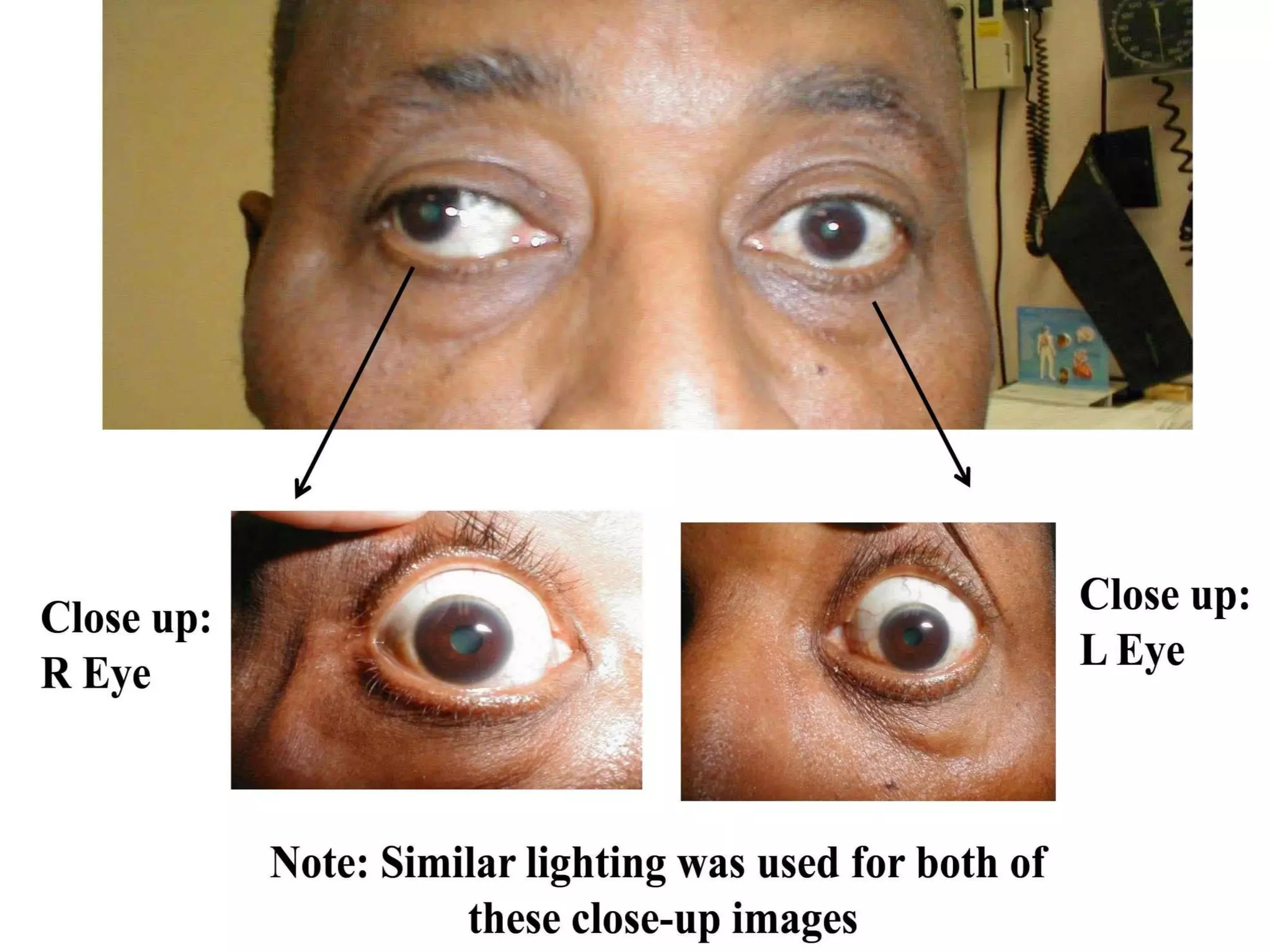Ocular motility and gaze | PDF