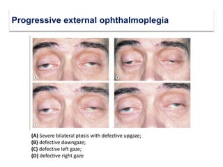 Ocular motility and gaze | PDF