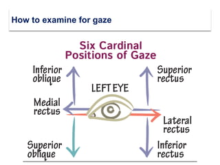 Ocular motility and gaze | PDF