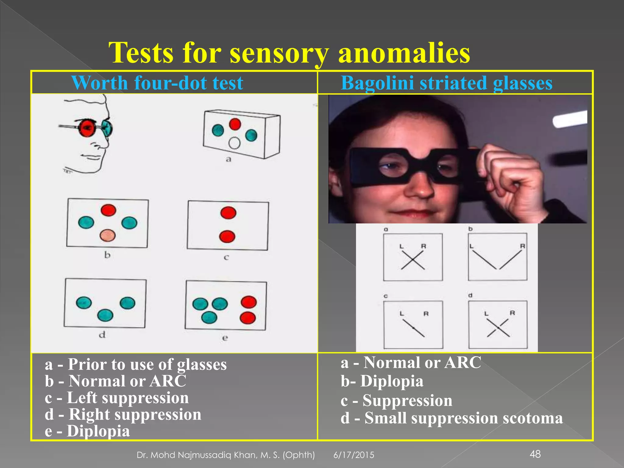 Ocular motility and strabismus | PPTX