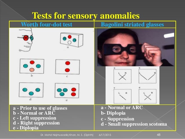 Ocular motility and strabismus