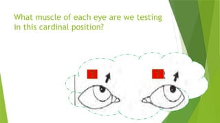 Ocular Motility, Extra-Ocular Muscles NDORI.pptx