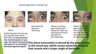 Ocular Motility, Extra-Ocular Muscles NDORI.pptx
