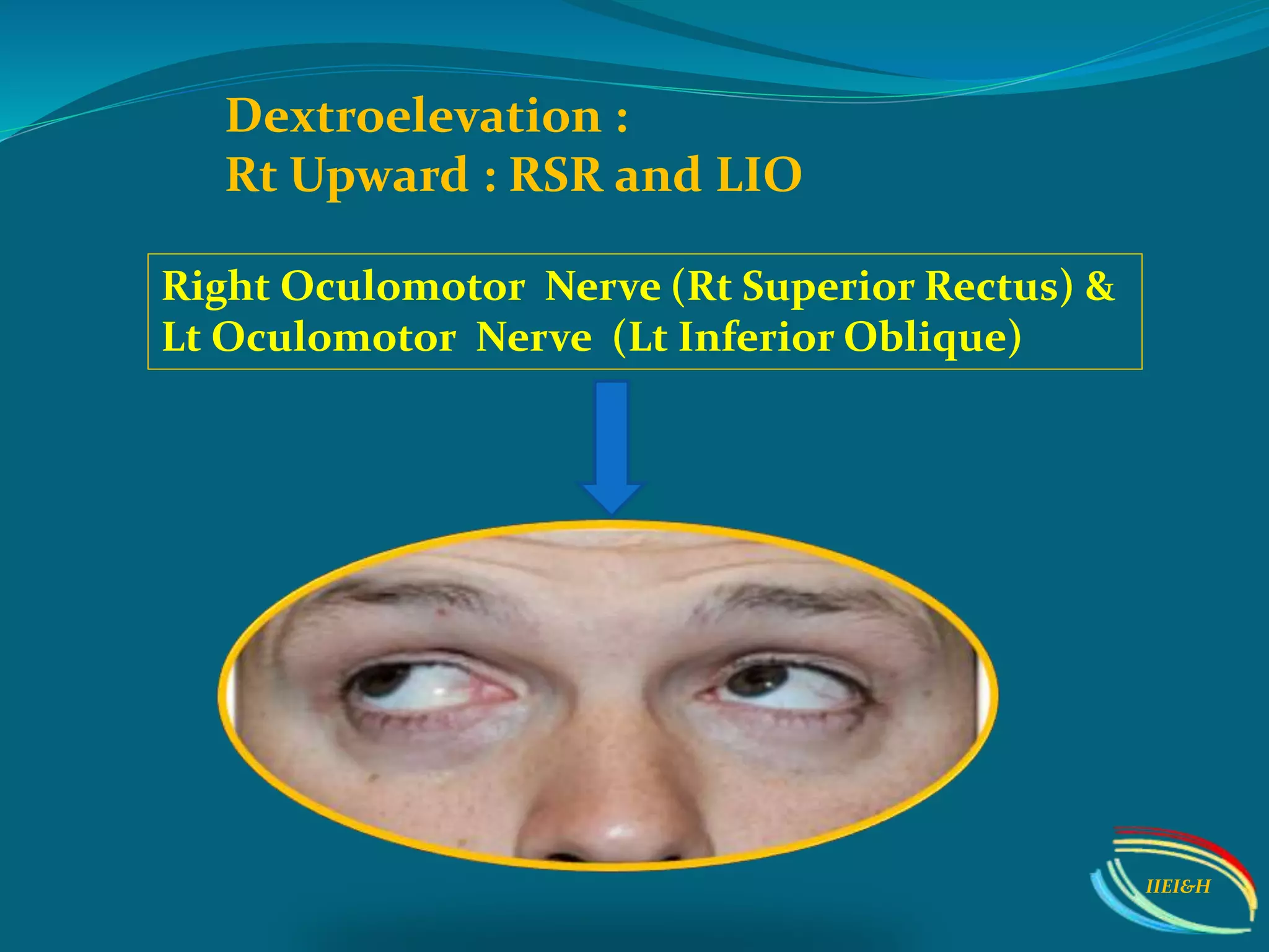 Ocular motility test | PPTX