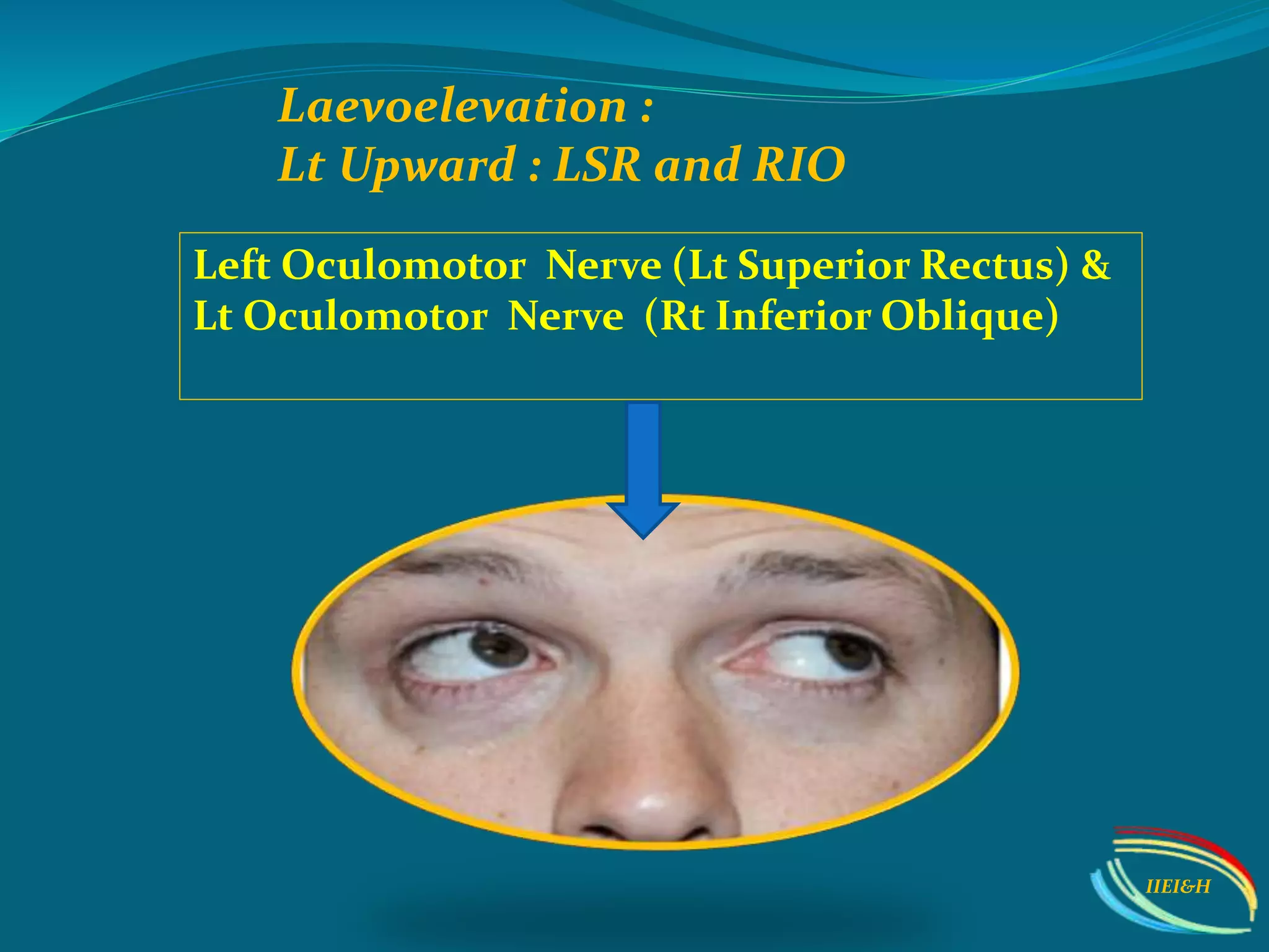 Ocular motility test | PPTX