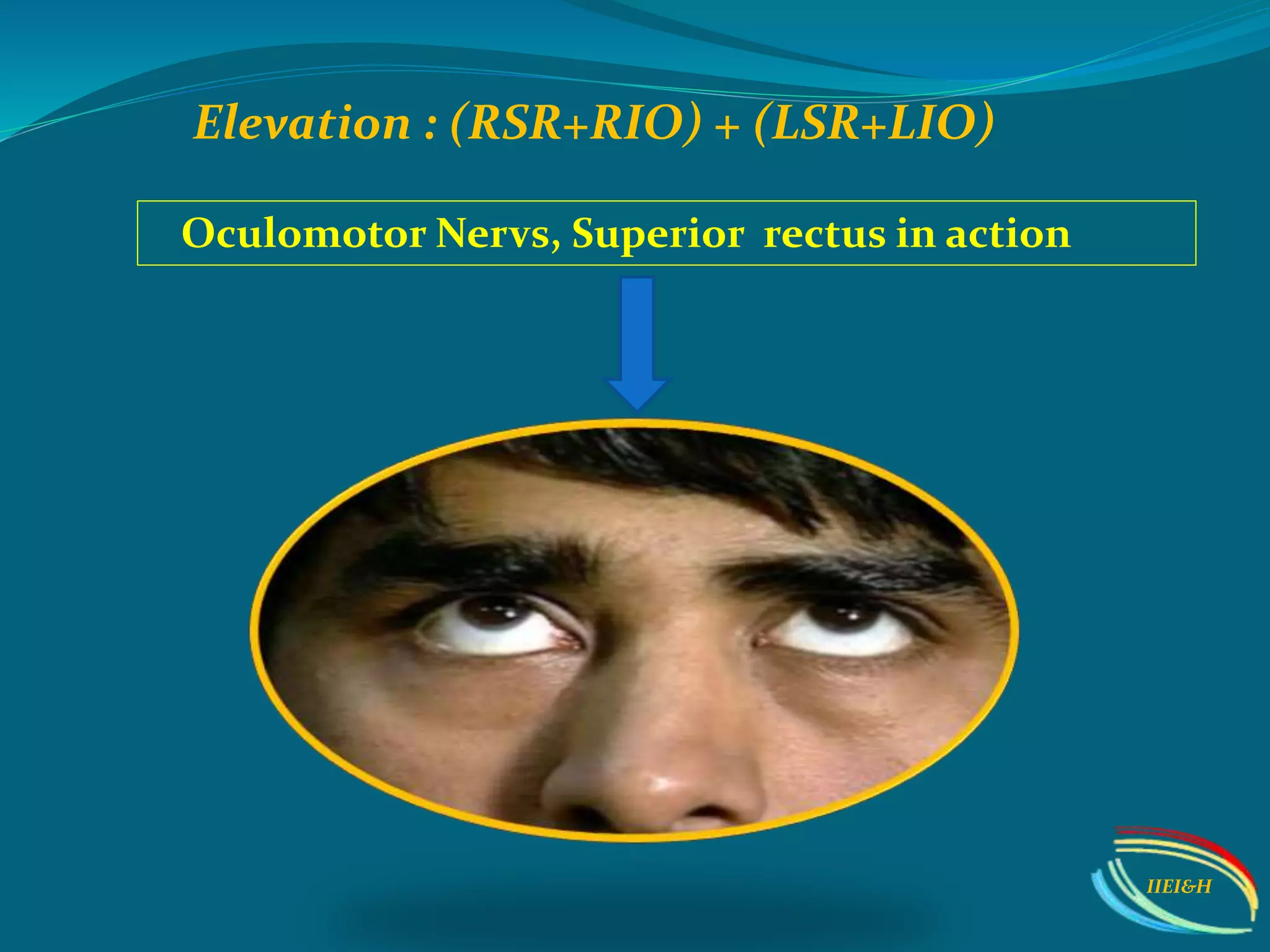 Ocular motility test | PPTX