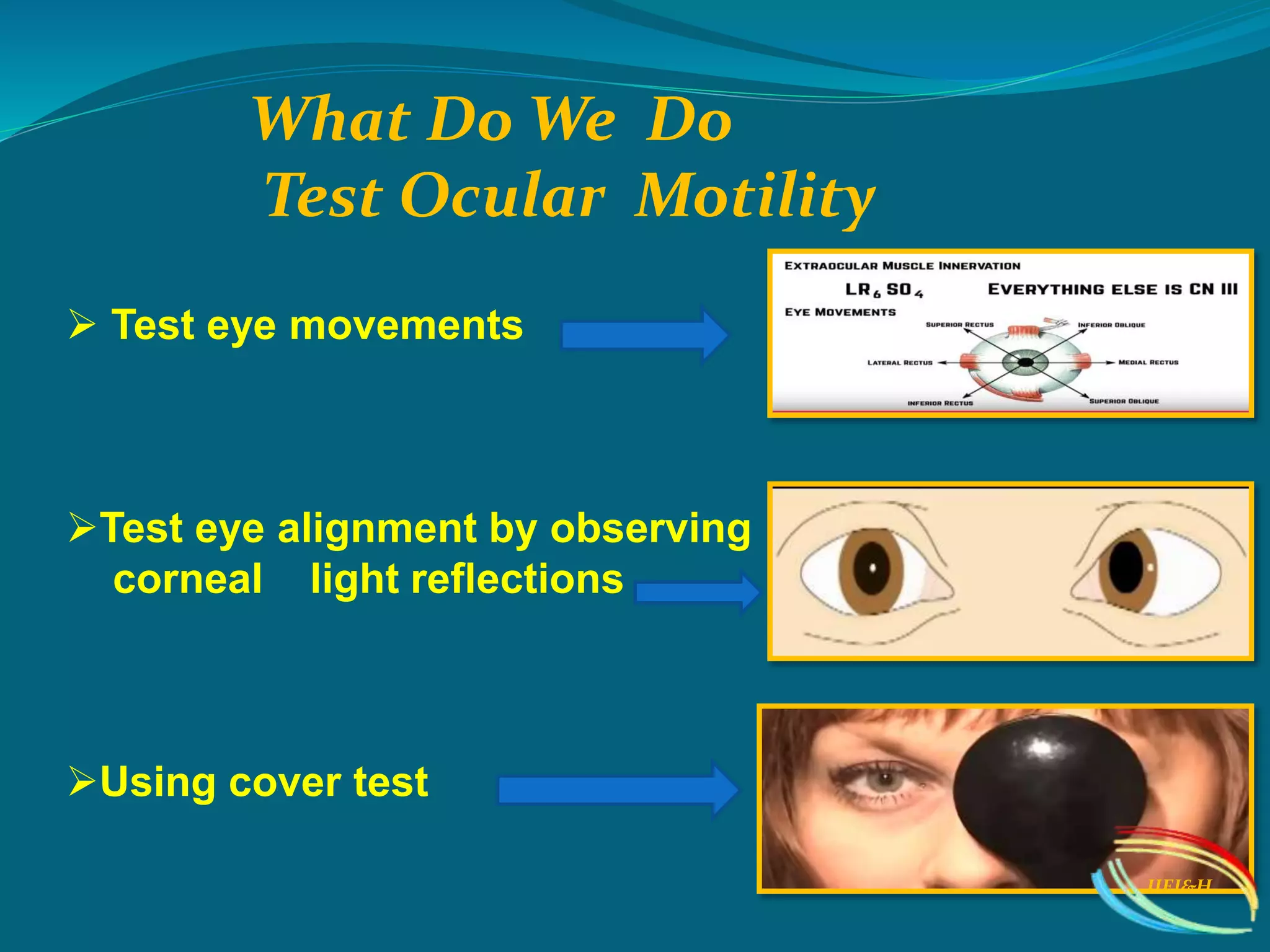 Ocular motility test | PPTX
