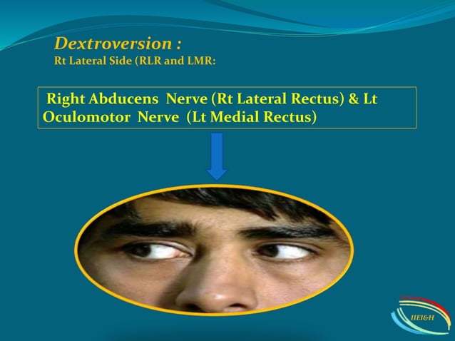 Ocular motility test | PPTX