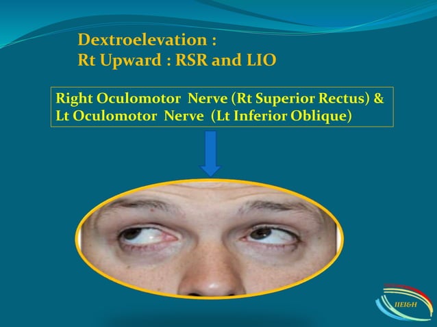 Ocular motility test | PPTX