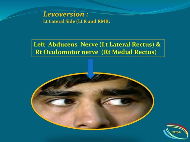 Ocular motility test | PPTX