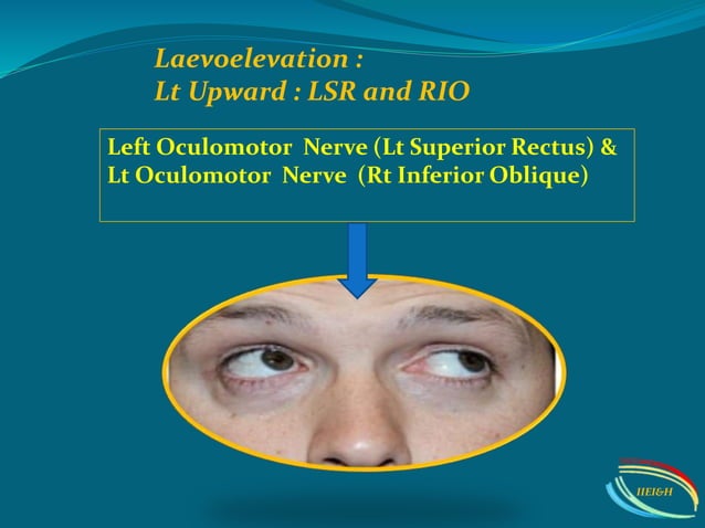 Ocular motility test | PPTX