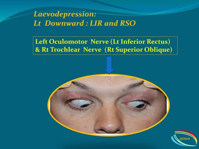 Ocular motility test | PPTX