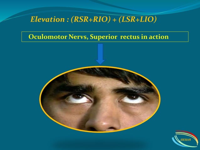 Ocular motility test | PPTX