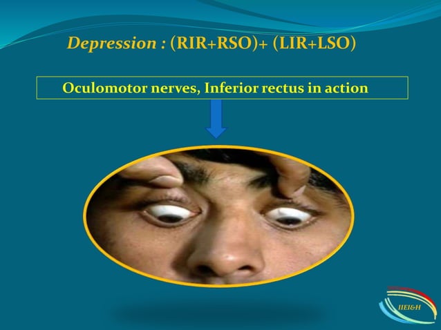 Ocular motility test | PPTX