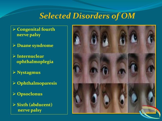 Ocular motility test | PPTX