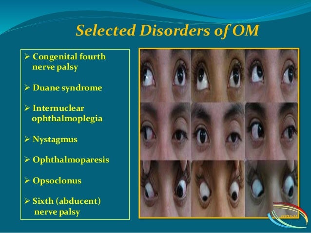 Ocular motility test
