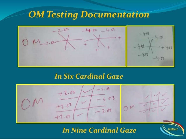 Ocular motility test