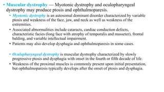 Ocular myasthenia | PPTX