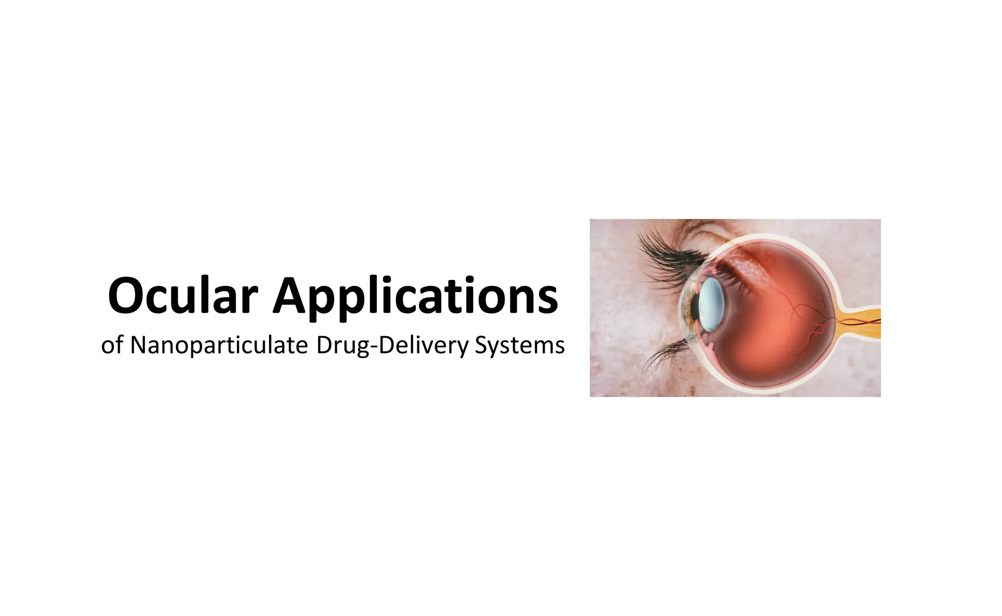 ocular applications of nanoparticulate drug delivery systems | PDF