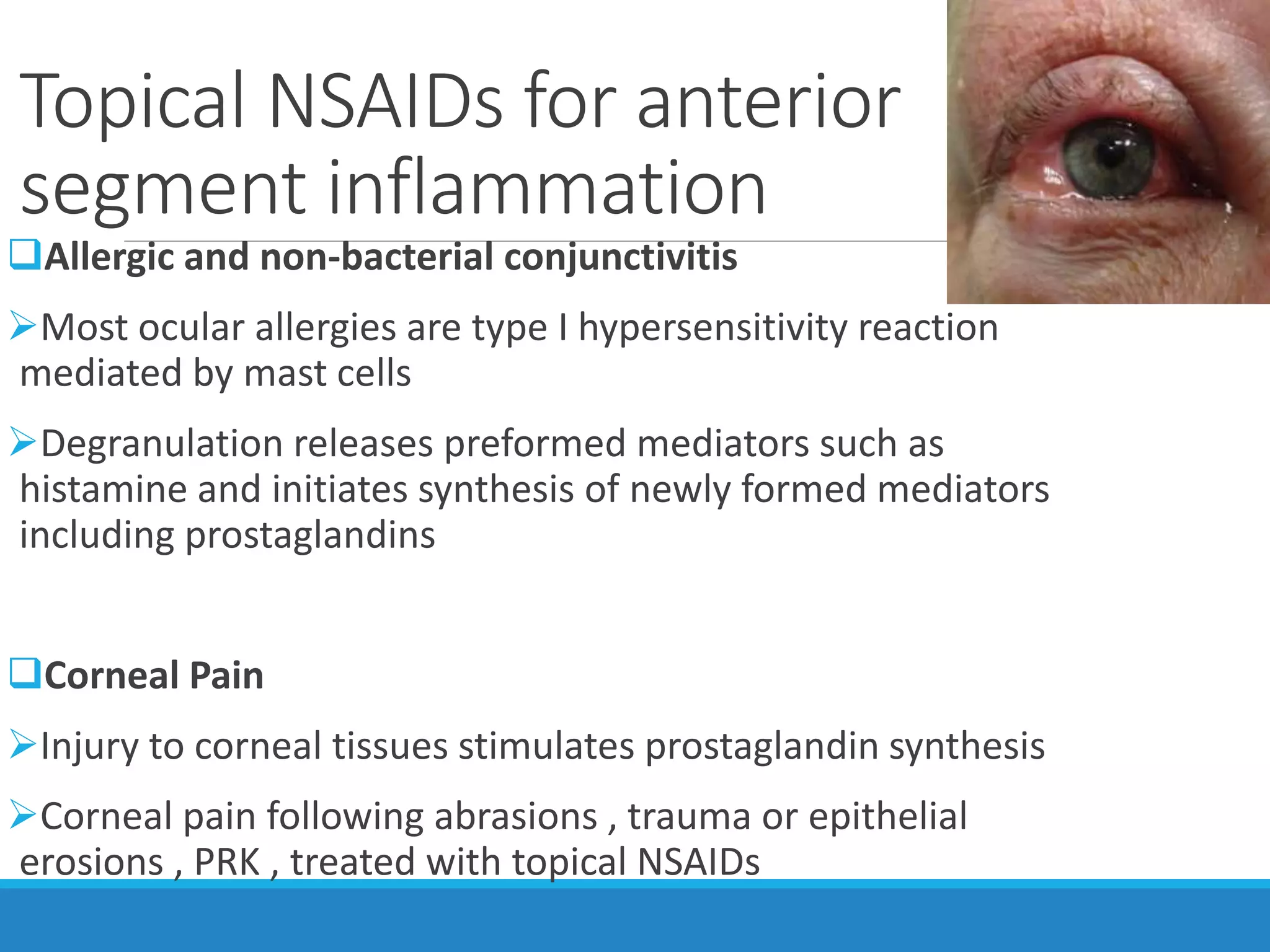 Ocular NSAIDs and Steroids | PPTX