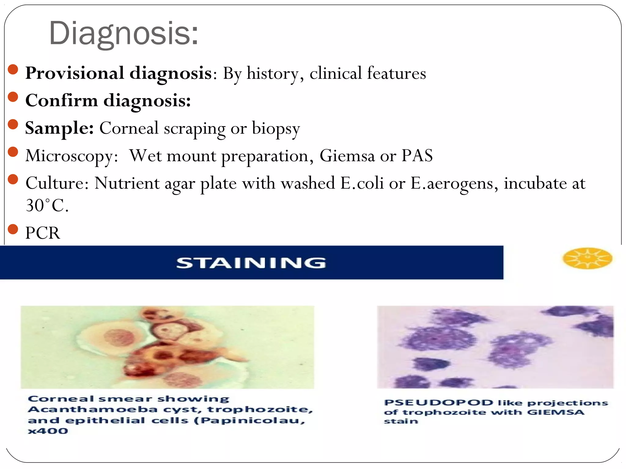Ocular parasitic infection | PPT