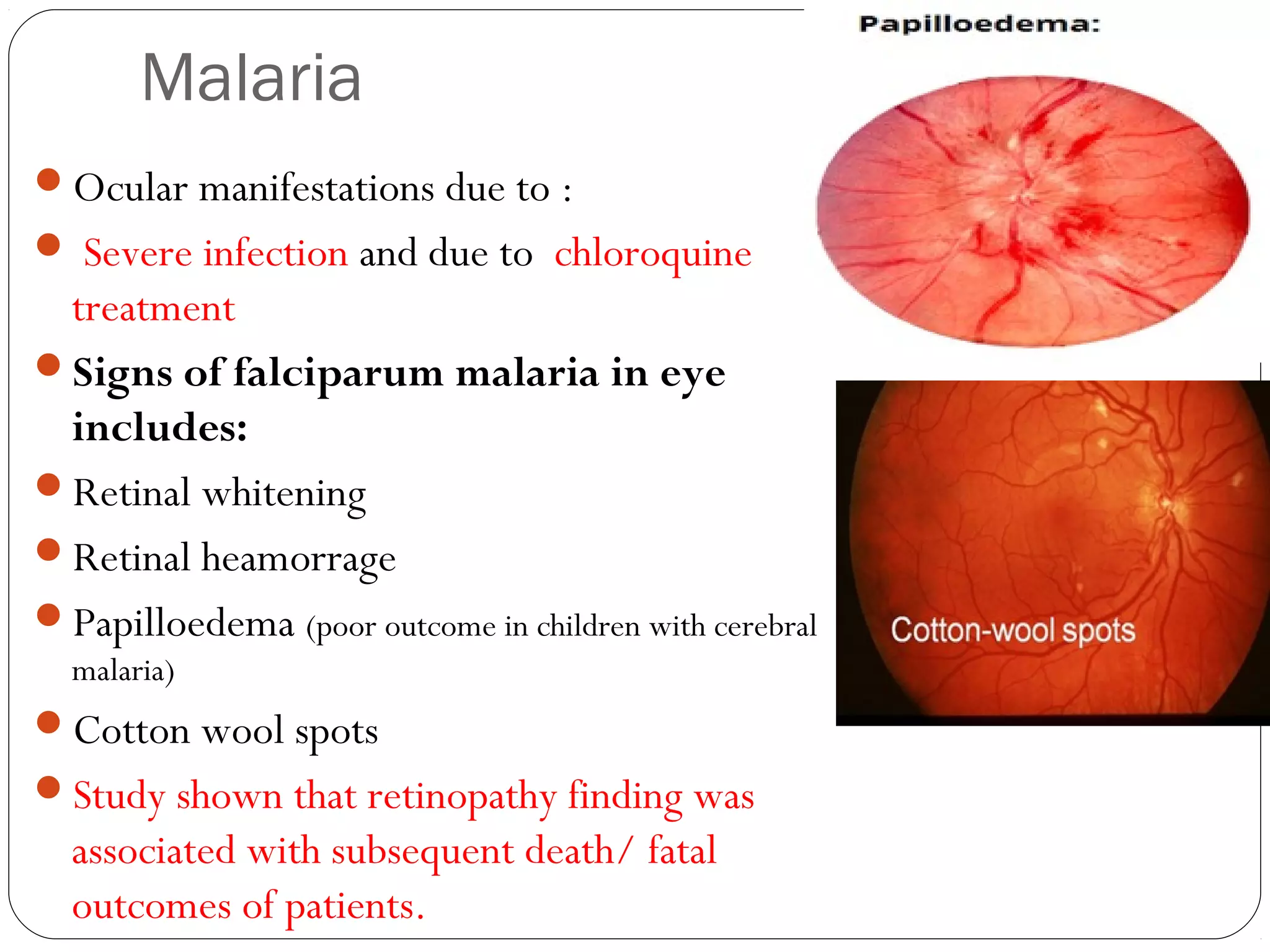Ocular parasitic infection | PPT
