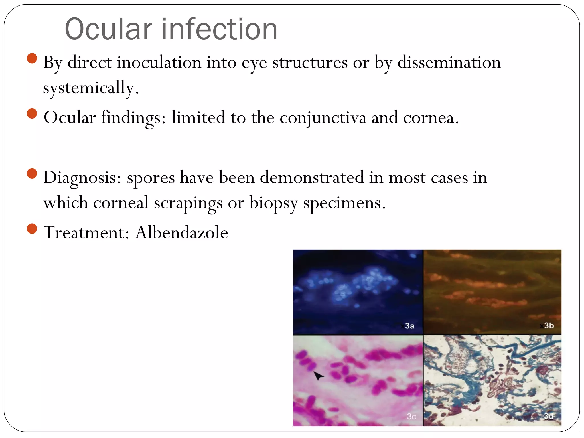 Ocular parasitic infection | PPT