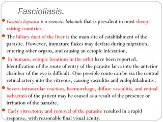 Ocular parasitic infection | PPT