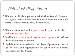Ocular parasitic infection | PPT