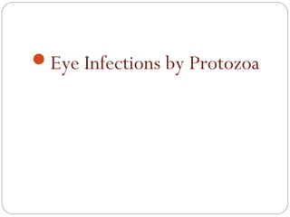 Ocular parasitic infection | PPT