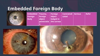 OCULAR PATHOLOGY______Refresher.pptx