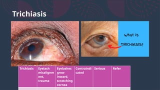 OCULAR PATHOLOGY______Refresher.pptx