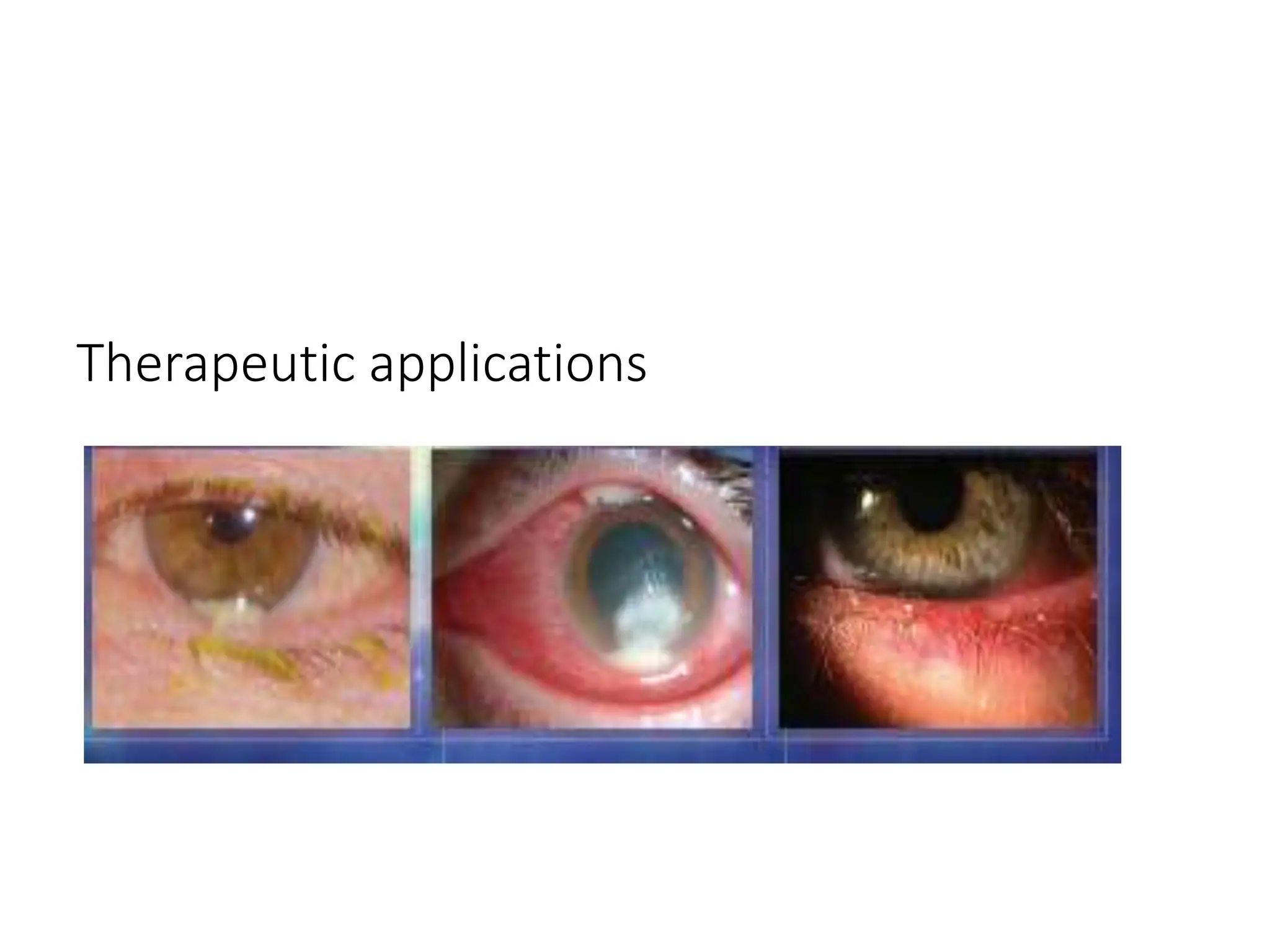 ocular pharmacology for optical std.pptx