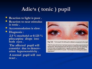 Ocular Pharmacology (pharmacokinetics, drug absorption, distribution ...