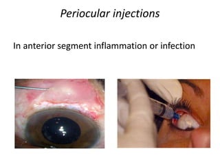 Ocular pharmacology i,dr.kuricnchi,16.03.17