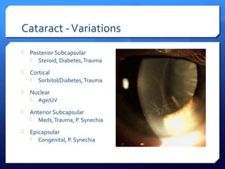 Selected Ocular Disorders & Procedures | PPT