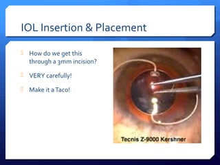 Selected Ocular Disorders & Procedures | PPT