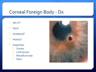 Selected Ocular Disorders & Procedures | PPT