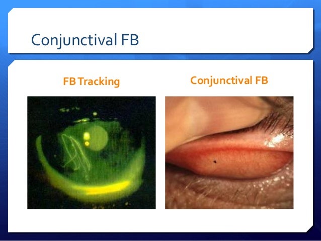 Selected Ocular Disorders & Procedures