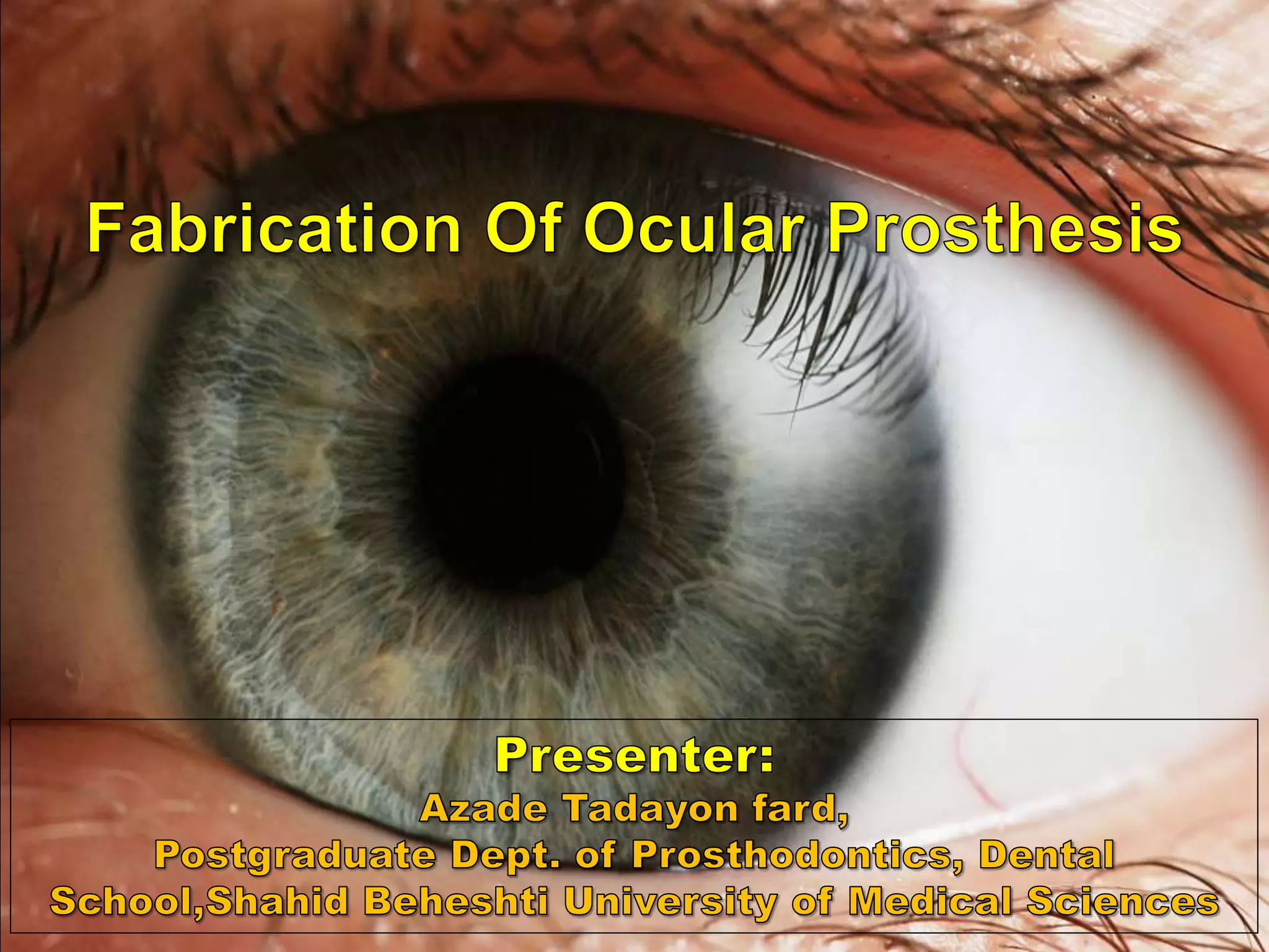 Ocular Prosthesis Fabrication | PPTX